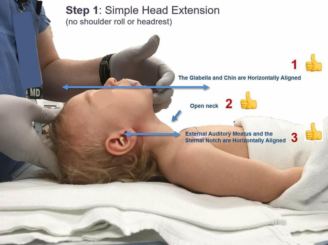 Xử trí sơ cấp cứu ngạt nước, đuối nước tại hiện trường - Xét nghiệm Dr.Labo